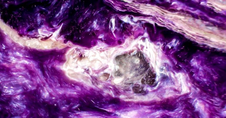 Gem Mining in Tennessee: 5 Places to Find Gems - Scenic States